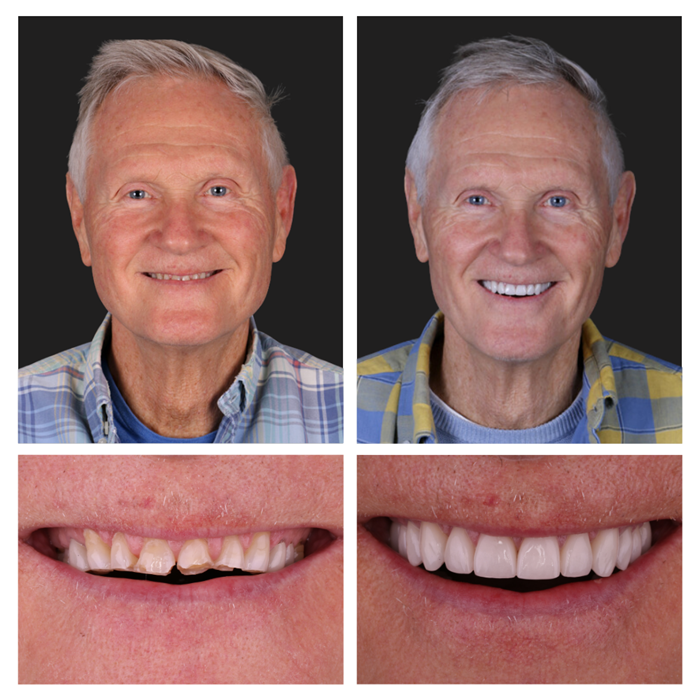 Roy’s Story | Paradise Dental